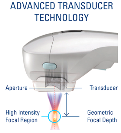 Micro-focused Ultrasound - CosmeticMe